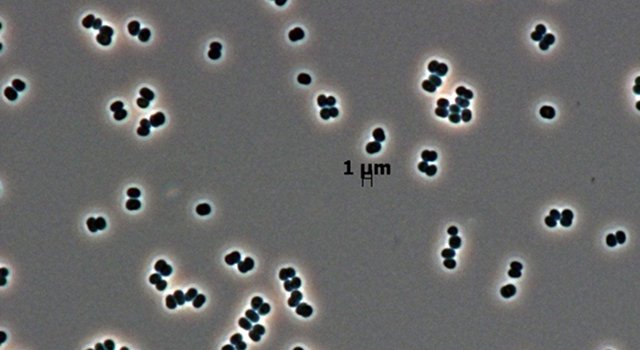 Rare New Microbe Found in Two Distant Clean Rooms | NASA Jet Propulsion ...
